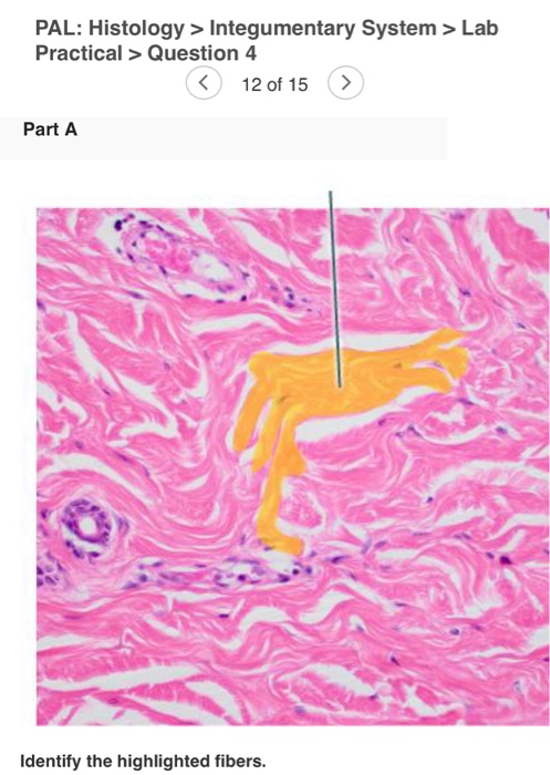 Solved PAL: Histology>Integumentary System > Lab Practical | Chegg.com