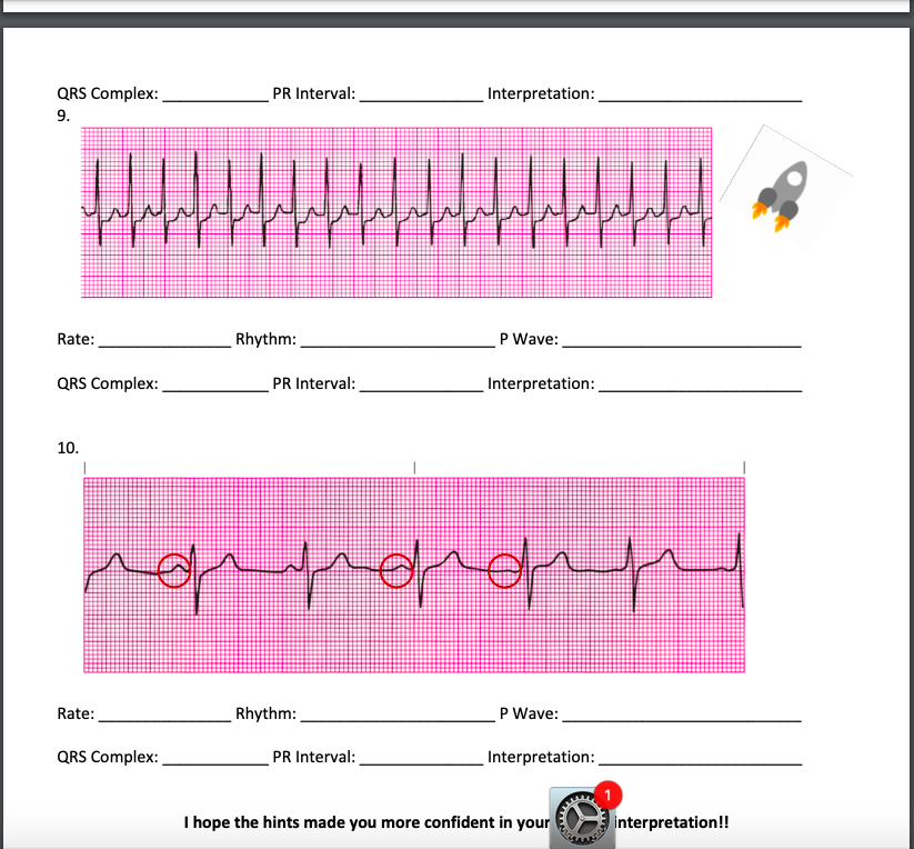 Solved Rate: Rhythm: P Wave: QRS Complex: PR Interval: | Chegg.com