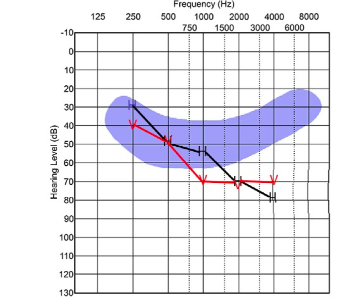Solved Describe what she would be able to detect and | Chegg.com
