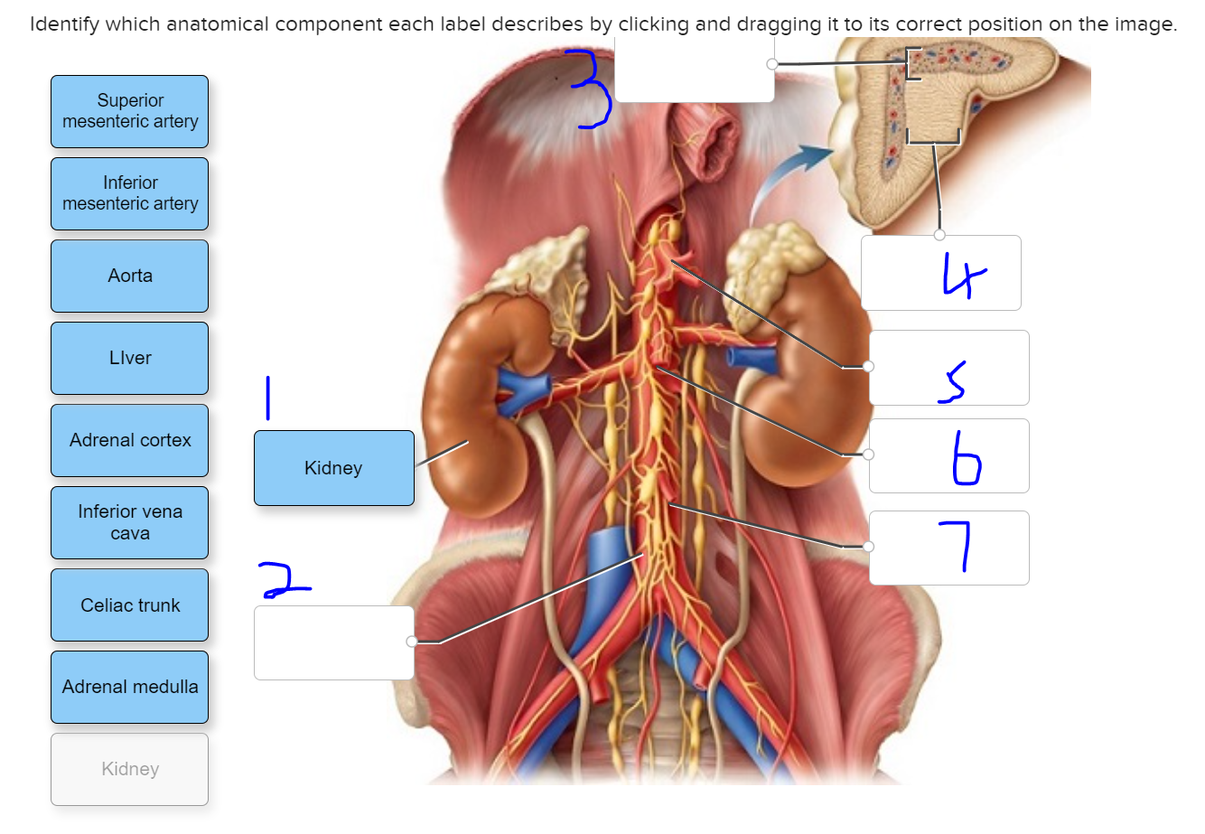 Solved Identify which anatomical component each label | Chegg.com