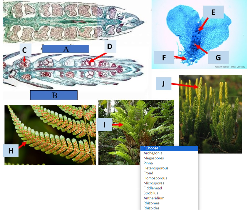 Solved Match the letters to the structures listed. | Chegg.com