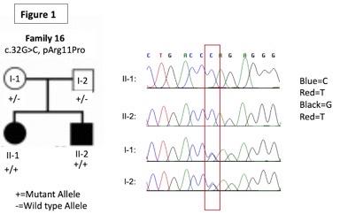 A 2020 paper describes novel mutations in the NARS1 | Chegg.com