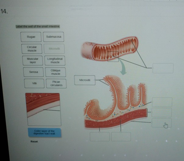 Solved 14. Label the wall of the small intestine. Rugae | Chegg.com
