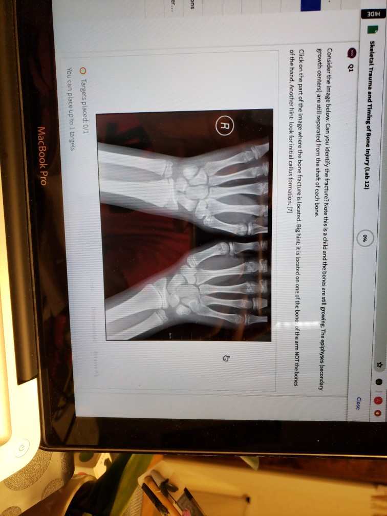 Solved 2 Skeletal Trauma and Timing of Bone Injury (Lab 12) | Chegg.com