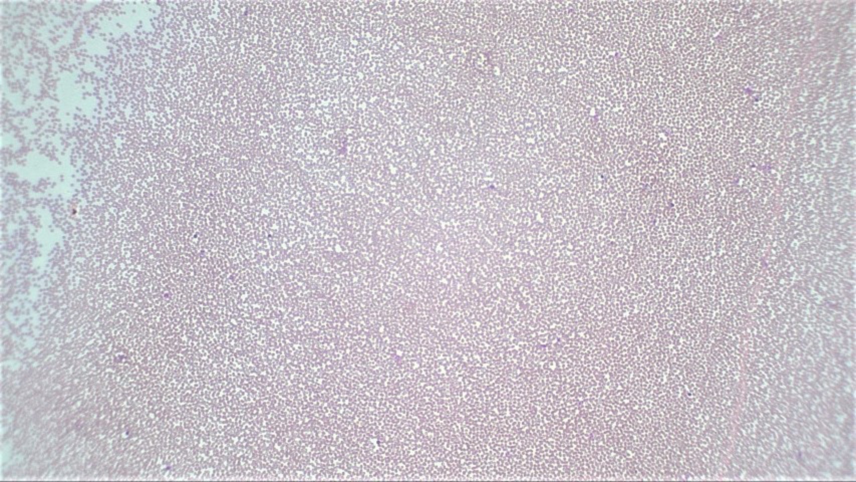 Solved Is this photo a hypotonic, hypertonic, or isotonic | Chegg.com