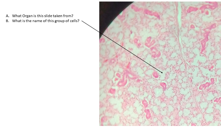 A. What Organ is this slide taken from? B. What is | Chegg.com