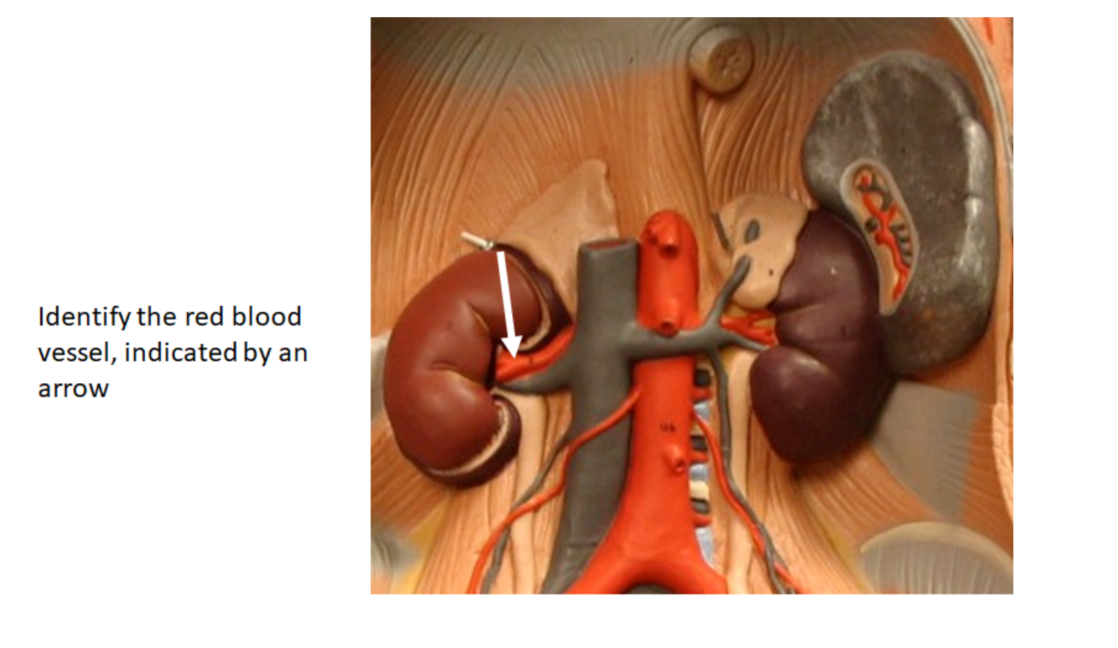 Solved Identify the red blood vessel, indicated by an arrow | Chegg.com