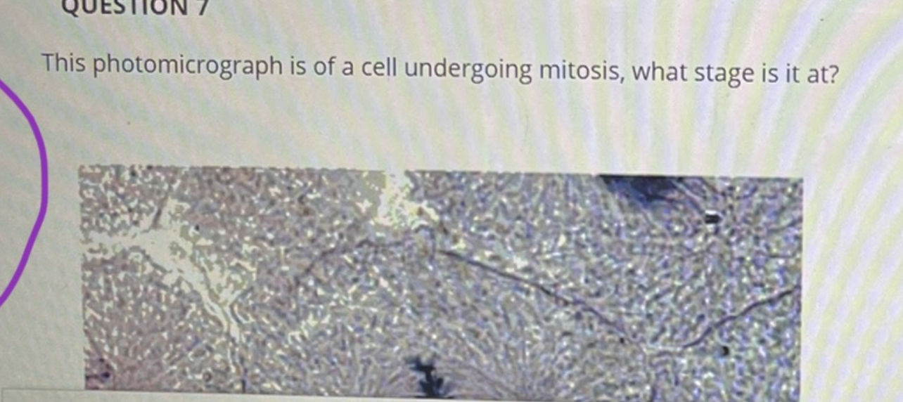 Solved This photomicrograph is of a cell undergoing mitosis, | Chegg.com