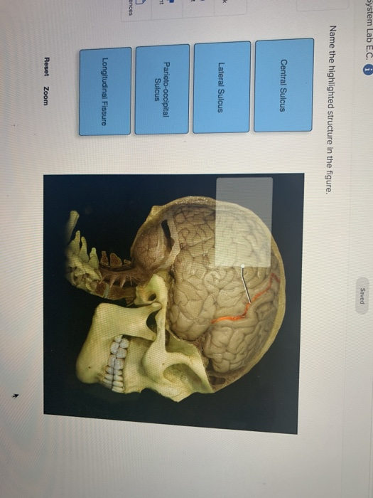 Solved System Lab E.C. G Saved Name the highlighted | Chegg.com