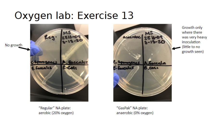 Solved Oxidase test: Exercise 14 A. faecalis E. coli E. | Chegg.com
