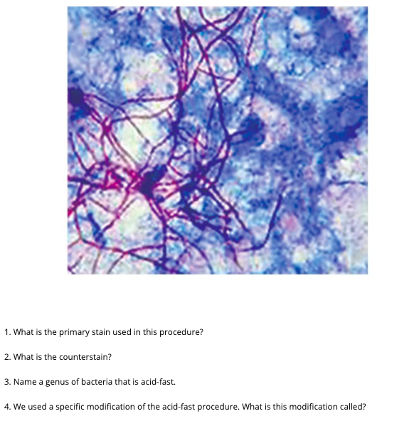 Solved 1. What is the primary stain used in this procedure? | Chegg.com