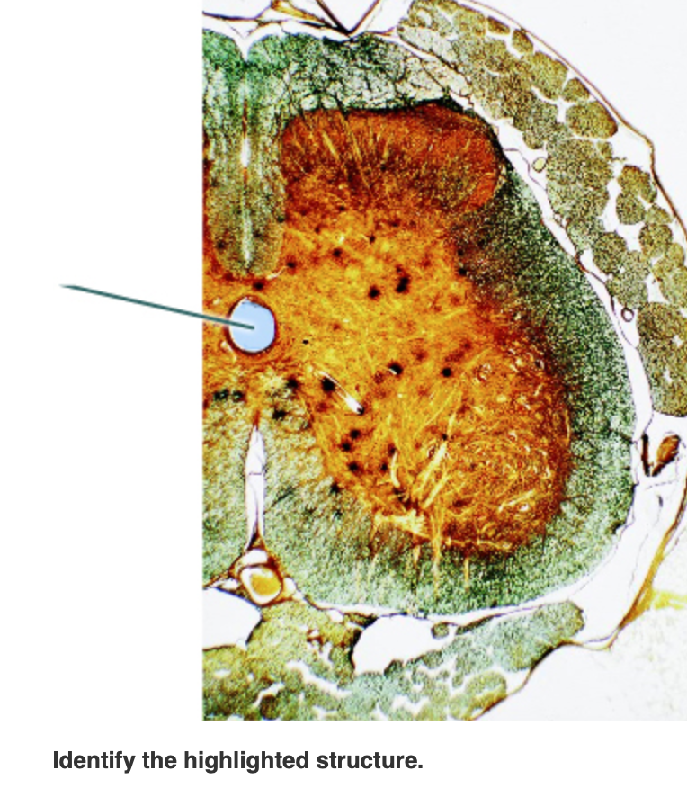 Solved Identify the highlighted structure. | Chegg.com