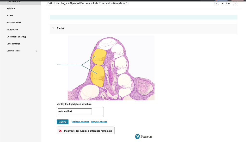 Solved PAL: Histology > Special Senses > Lab Practical > | Chegg.com Solved PAL: Histology > Special Senses > Lab Practical > | Chegg.com