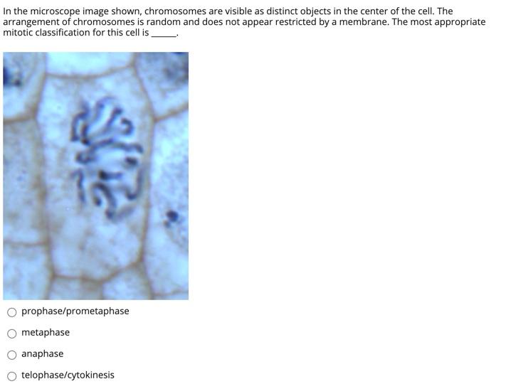 Prometaphase Microscope