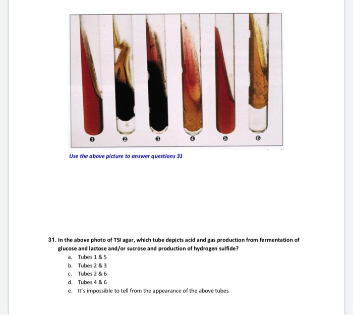 Solved 0 Use the above picture to answer questions 31 31. In | Chegg.com