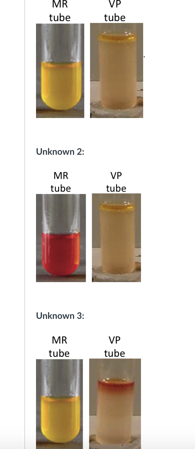 MR VP tube tube Unknown 2: Unknown 3: MR tube VP | Chegg.com