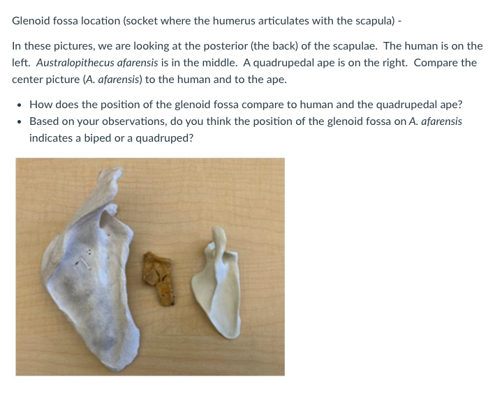Glenoid fossa location (socket where the humerus | Chegg.com