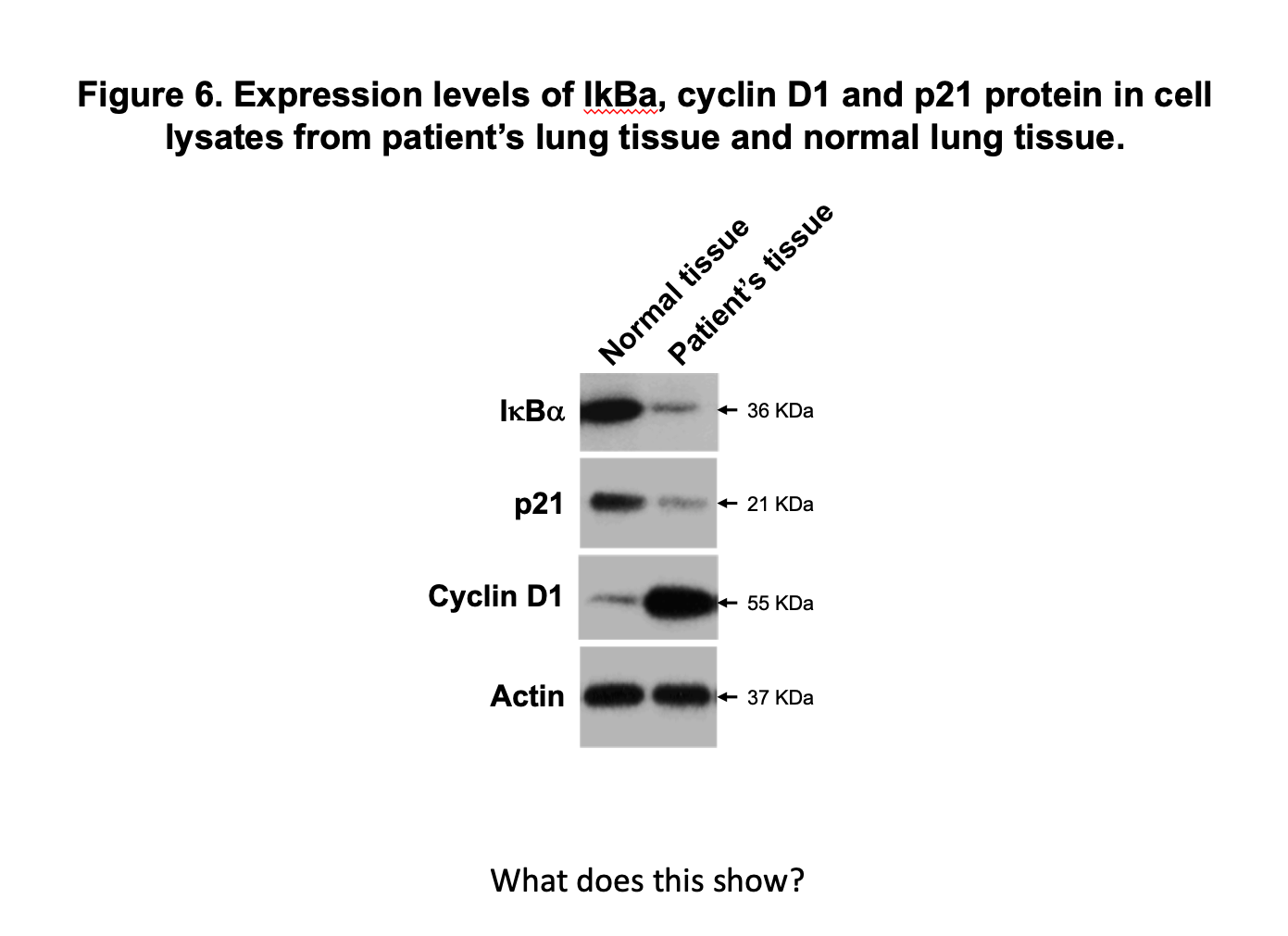 Solved Figure 6. Expression levels of IkBa, cyclin D1 and | Chegg.com