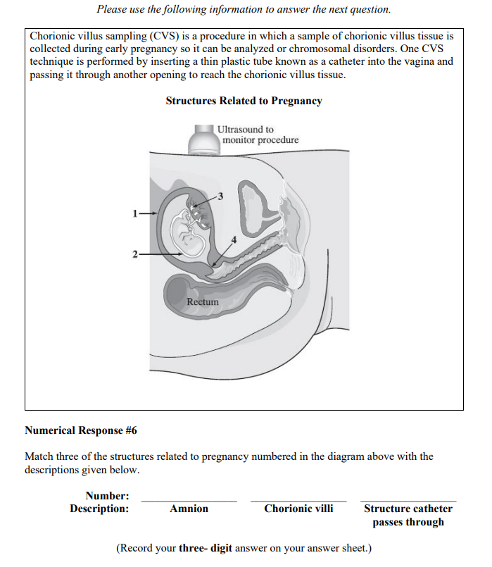 Chorionic Villus Sampling Diagram