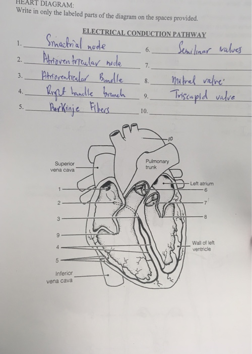 Solved HEART DIAGRAM: Write in only the labeled parts of the | Chegg.com