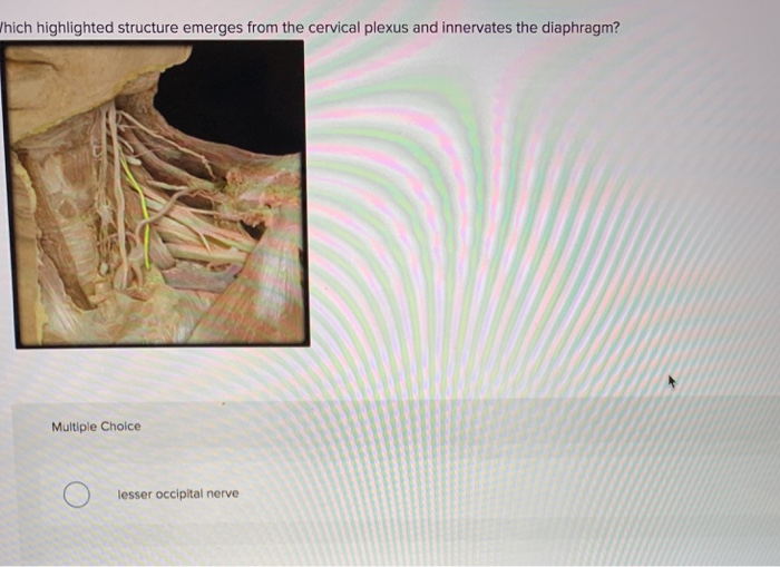 Solved Hich Highlighted Structure Emerges From The Cervical Chegg Solved Hich Highlighted Structure Emerges From The Cervical Chegg