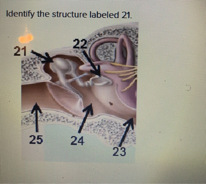 Solved is the solution that fills the chamber labeled 15. 18 | Chegg.com
