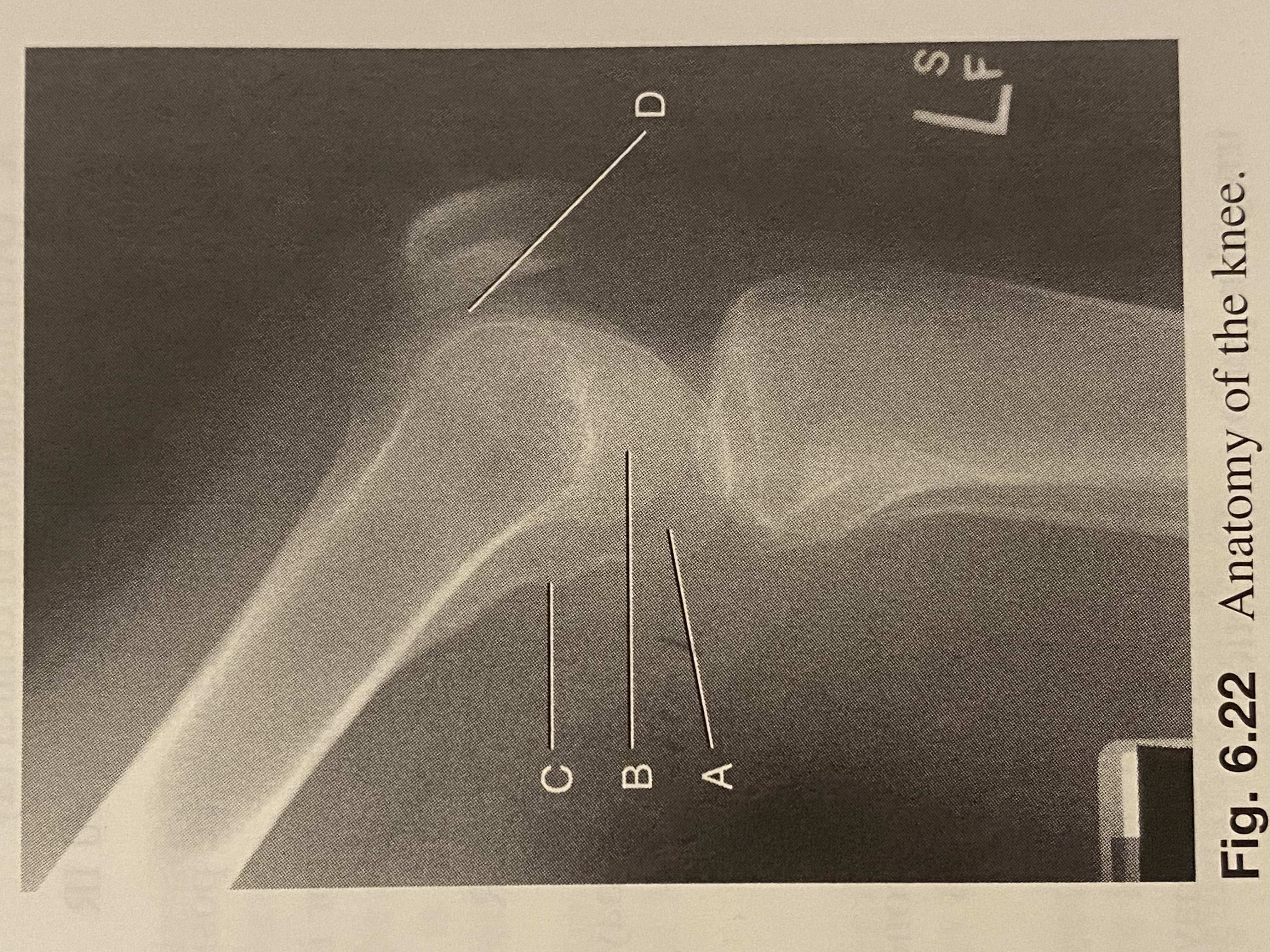 Solved 1. What is the primary position error present in Fig. | Chegg.com