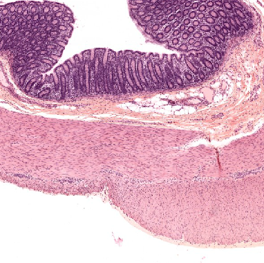 Taenia Coli Histology