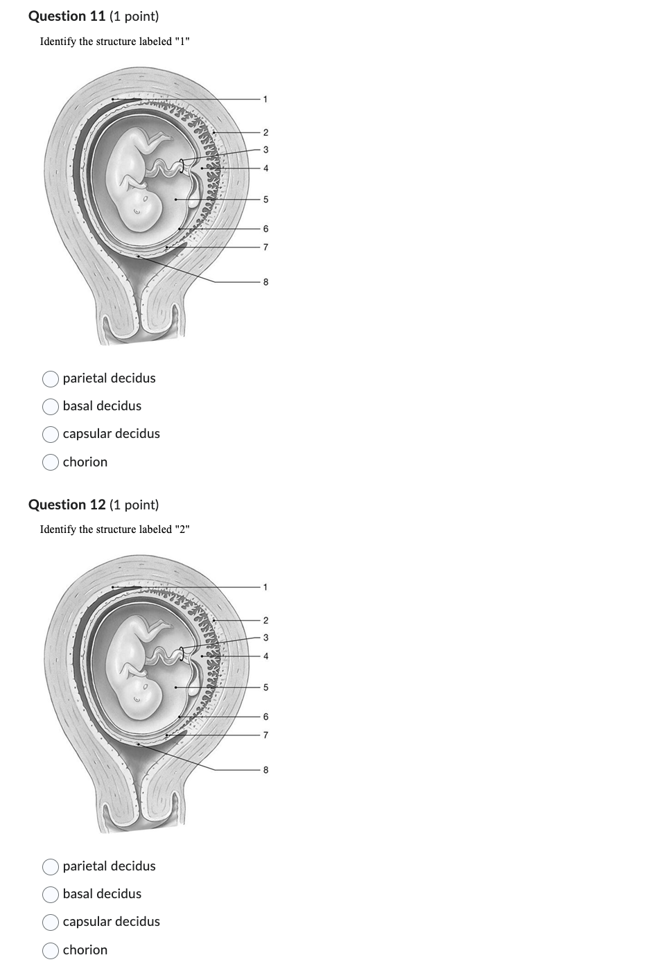 Solved Identify the structure labeled "1" parietal decidus | Chegg.com