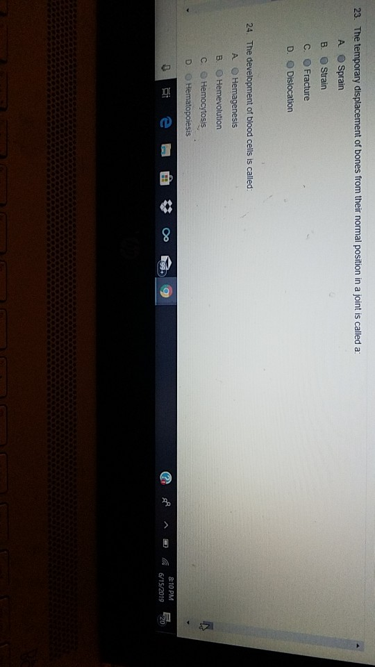 Solved EC demauts may be caused by A OViral infections or a | Chegg.com