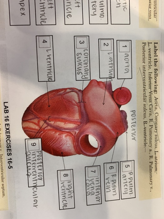 Solved entricular erior vena Label the following: Aorta, | Chegg.com