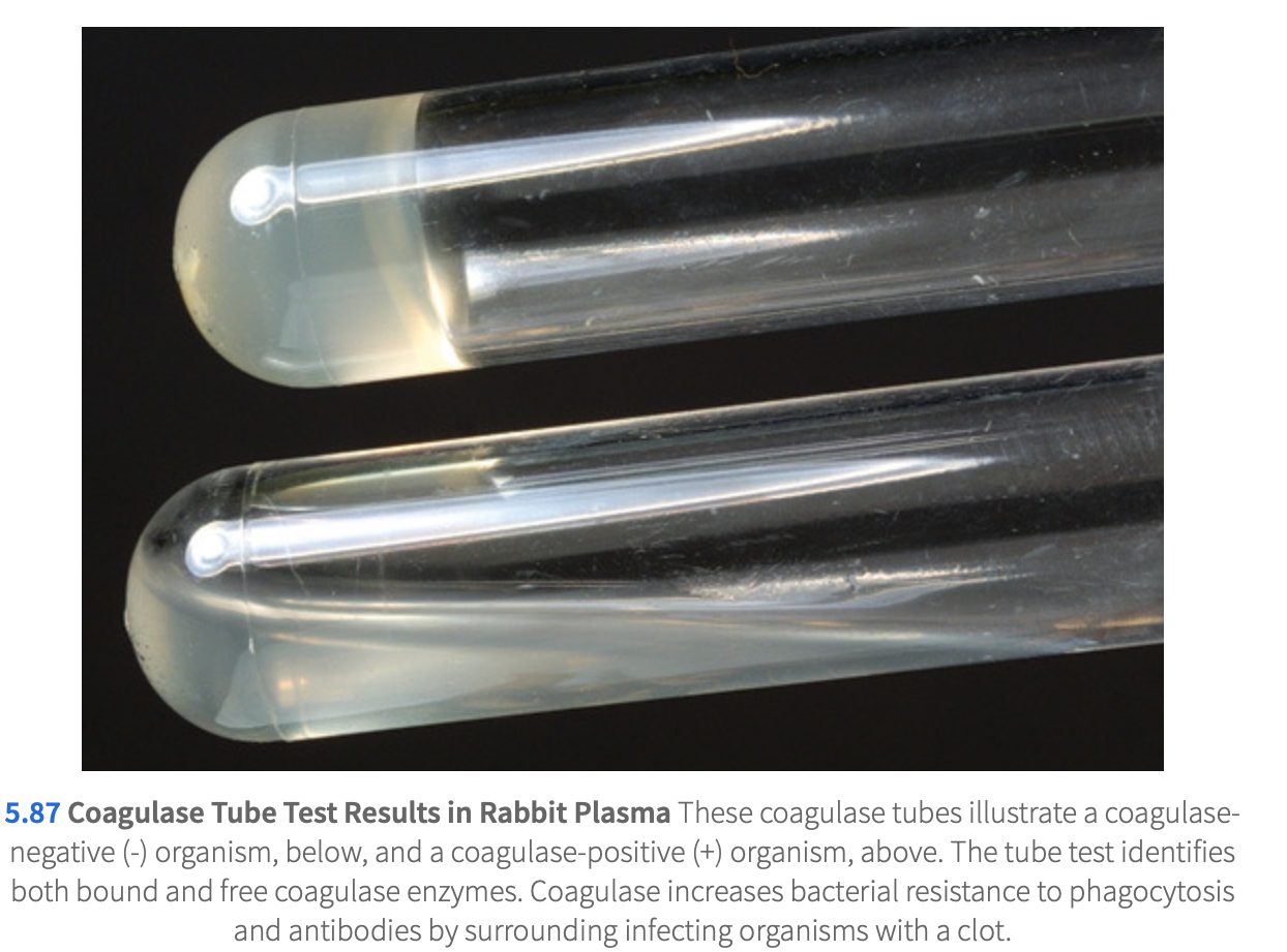 Solved 5.88 Coagulase Slide Test (Clumping Factor) This | Chegg.com