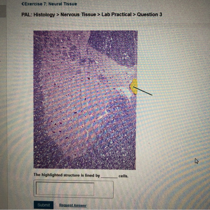 Solved KExercise 7: Neural Tissue PAL: Histology > Nervous | Chegg.com