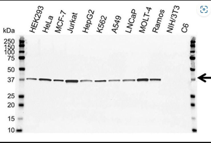 Solved Describe the results of the attached western blot in | Chegg.com