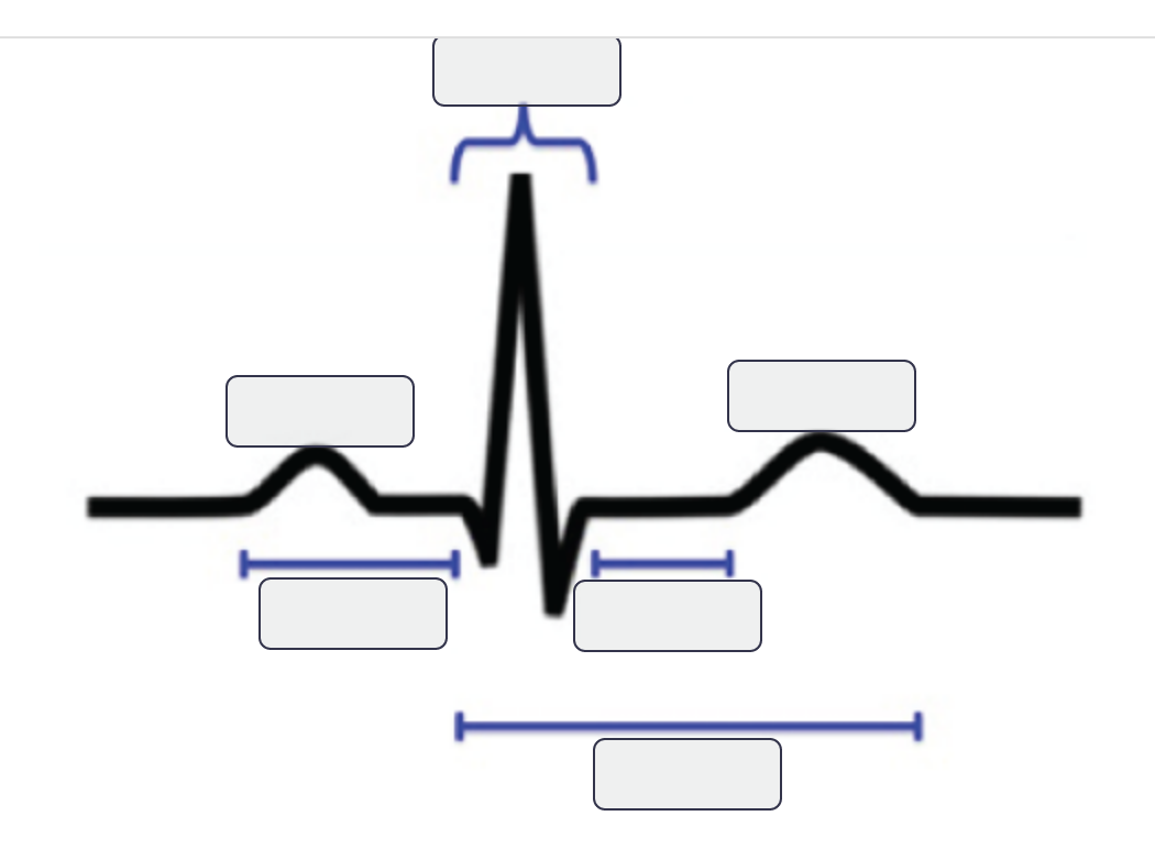 Solved The Components Of A Typical ECG Tracing Consist Of Chegg Solved The Components Of A Typical ECG Tracing Consist Of Chegg