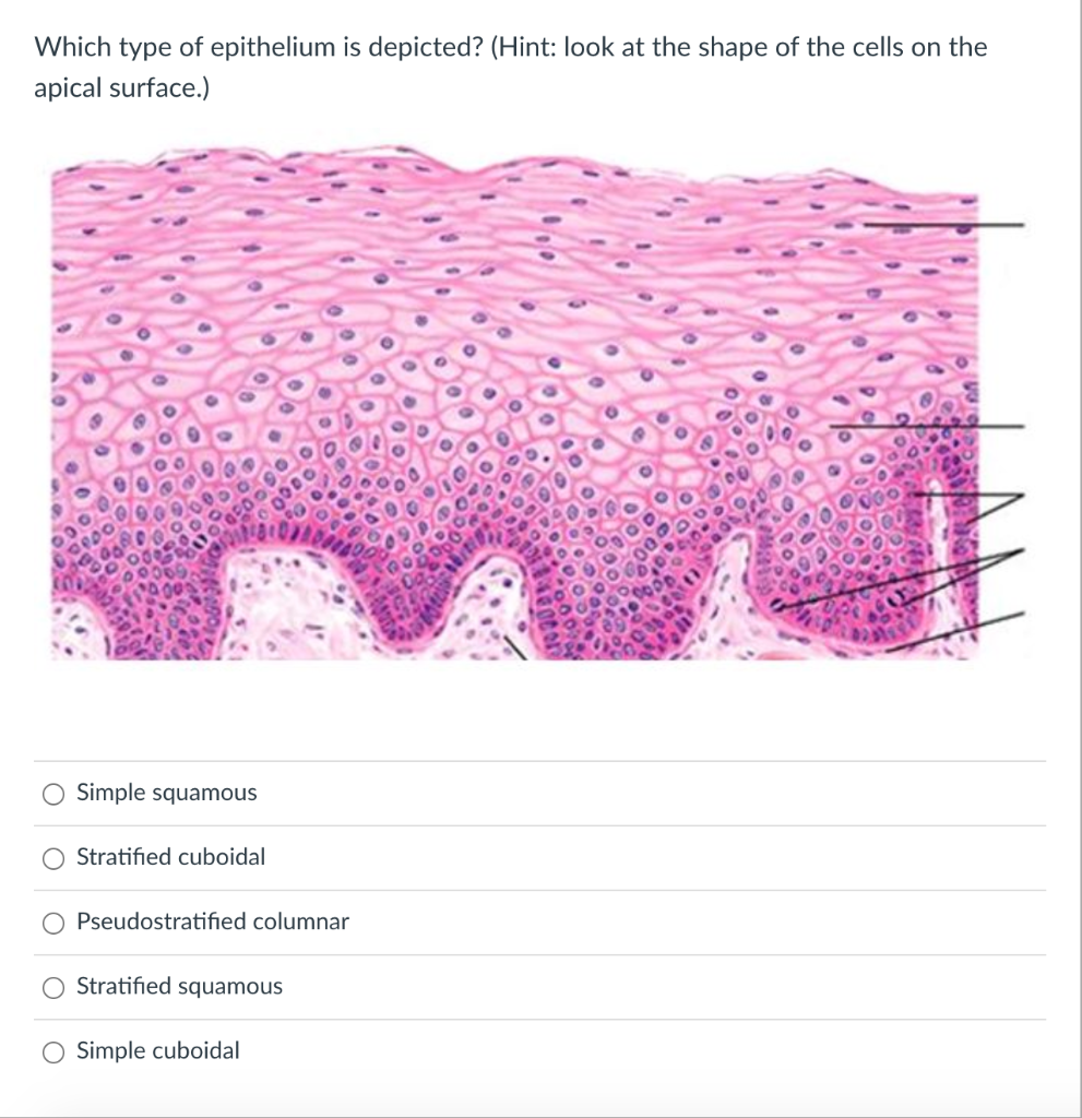 Solved Which type of epithelium is depicted? Simple squamous | Chegg.com