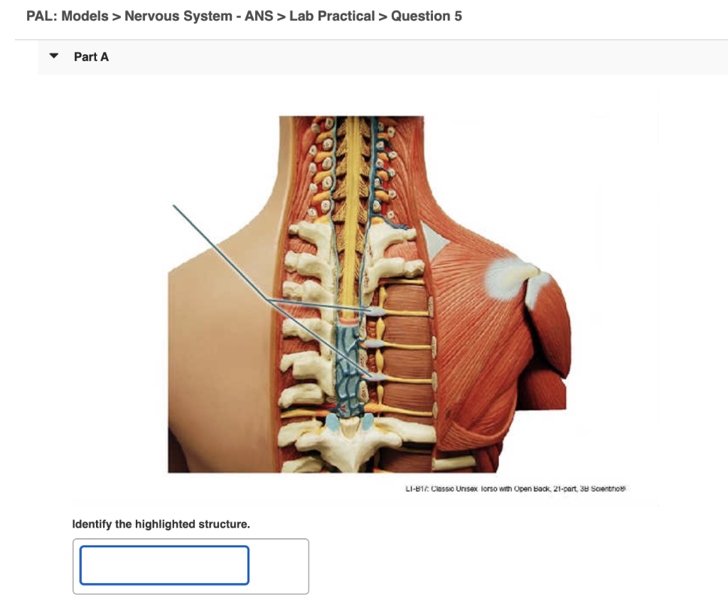 Solved PAL: Models > Nervous System - ANS > Lab Practical > | Chegg.com