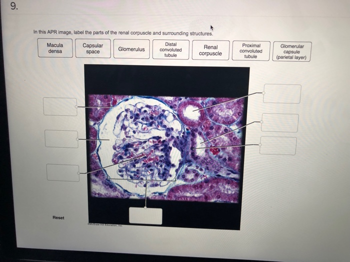 Solved In this APR image, label the parts of the renal | Chegg.com