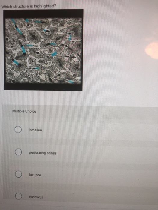 Solved Which structure is highlighted? Multiple Choice | Chegg.com