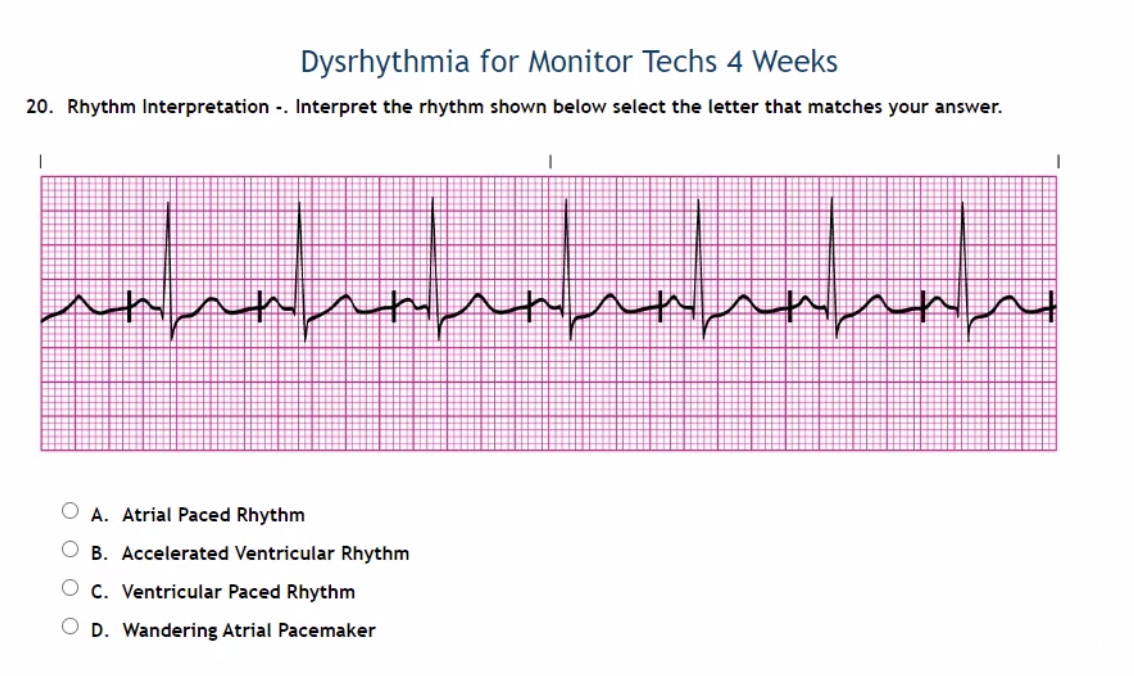 Solved Dysrhythmia for Monitor Techs 4 Weeks 20. Rhythm | Chegg.com