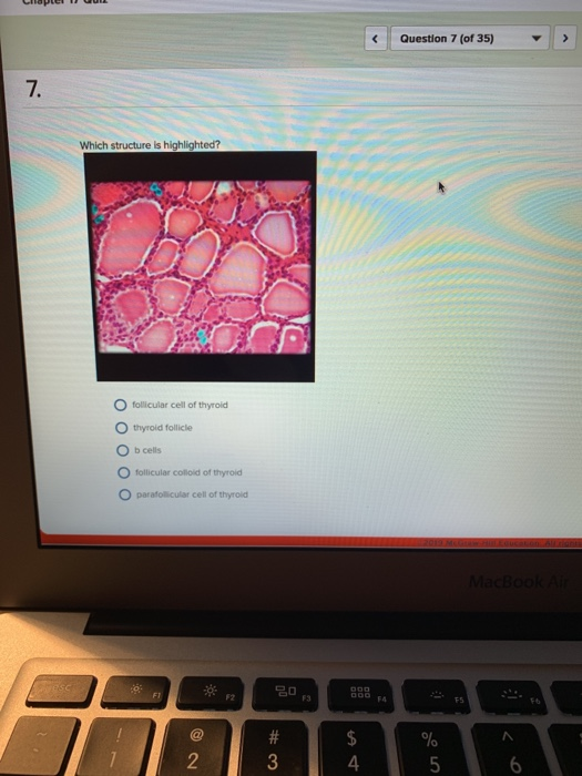 Solved Which structure is highlighted? Osuprarenal medulla | Chegg.com