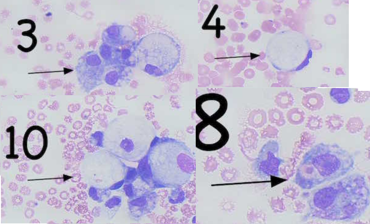 Solved identify the labeled cells from a peritoneal fluid | Chegg.com