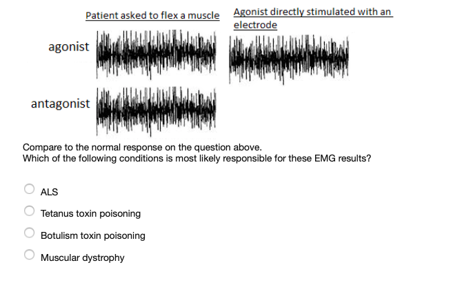 Patient asked to flex a muscle Agonist directly | Chegg.com