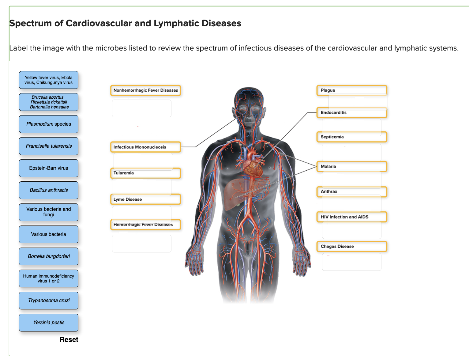 Solved Spectrum of Cardiovascular and Lymphatic Diseases | Chegg.com