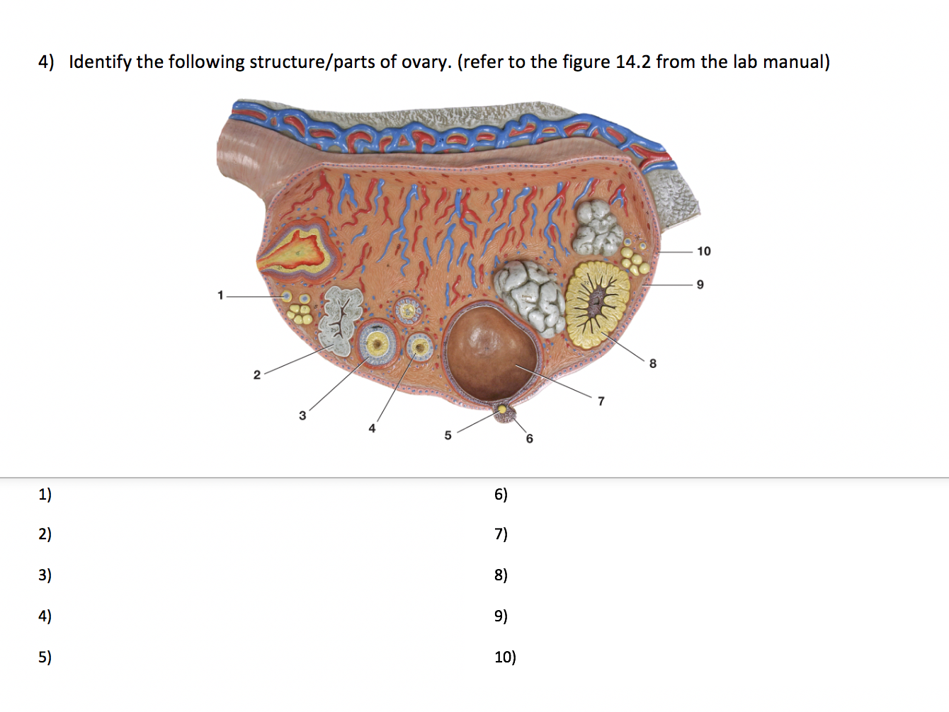 Solved 4) Identify the following structure/parts of ovary. | Chegg.com
