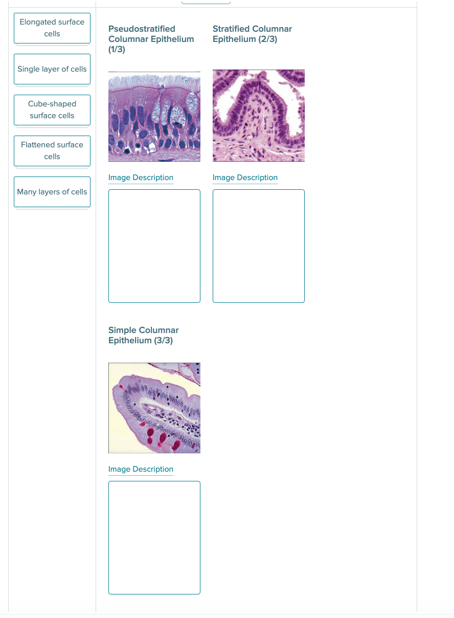 Solved PseudostratifiedColumnar Epithelium(1/3)Single layer | Chegg.com