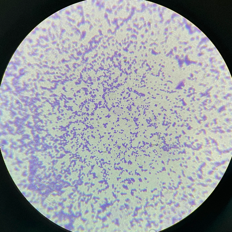 Solved Observation of the given bacteria Identify the given | Chegg.com