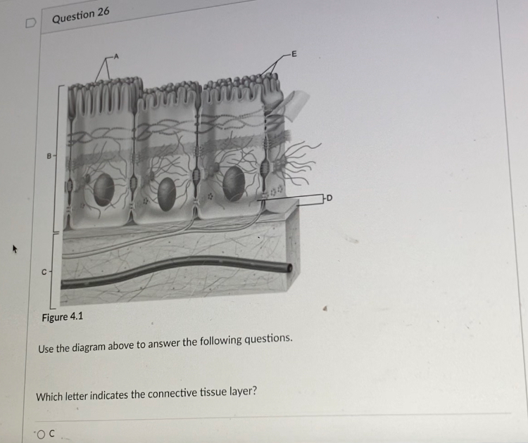 Solved Which letter indicates the connective tissue | Chegg.com