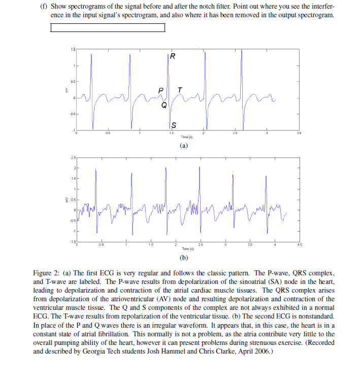 2.4 Notch Filter Removes Sinusoidal Interference The | Chegg.com