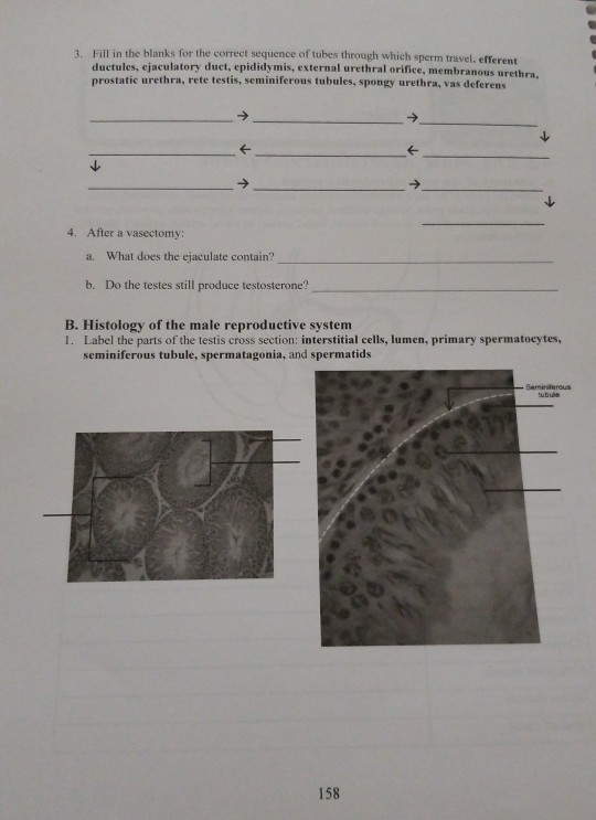 Solved Fill in the blanks for the correct sequence of tubes | Chegg.com